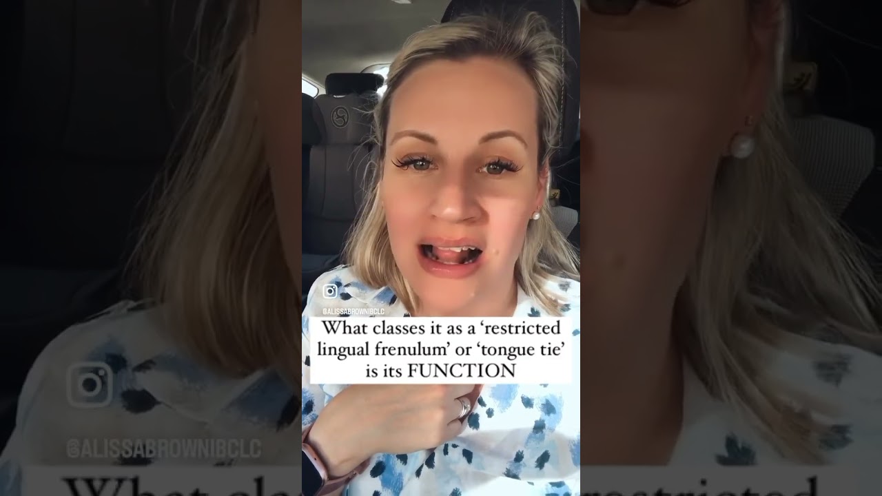 What actually is a TONGUE TIE? #normalizebreastfeeding #tonguetie #latch #breastfeeding