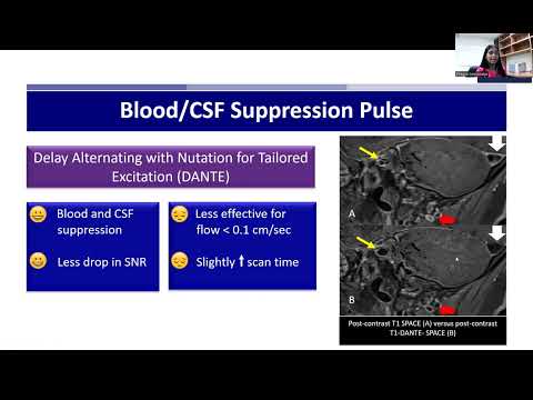 IVW SMRA webinar 982022