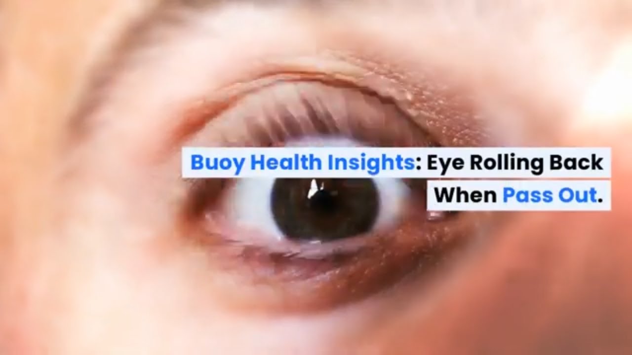 Eye Rolling Back: Common Causes and When to Seek Medical Care  | BuoyHealth.com