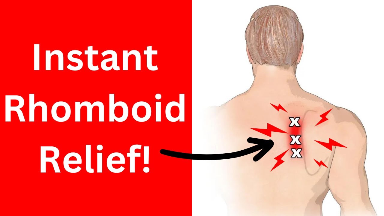 Fix Rhomboid Pain - With 2 Exercises.