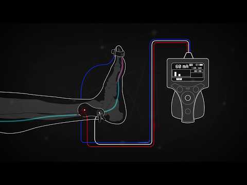 Nerve Stimulator - Omron Electrical Nerve Stimulator Latest Price ...