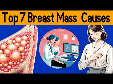 Lumps and Bumps in the Breast: top 7 Causes