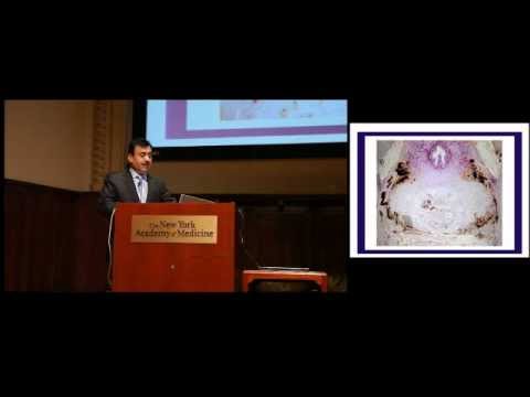 Prostate Cancer Treatment - Robotic Prostatectomy - Dr. Ash Tewari