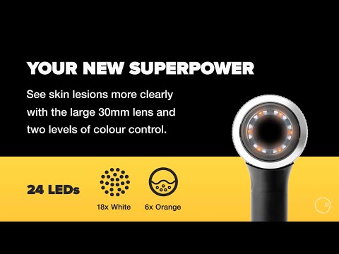 DermLite DL4 Dermatoscope | Nothing Comes Close