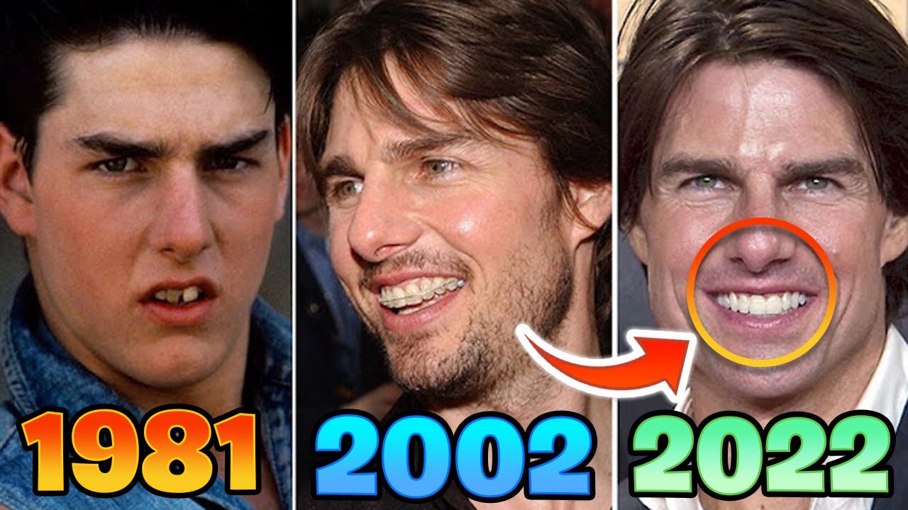 What's Wrong With Tom Cruise' Teeth?!