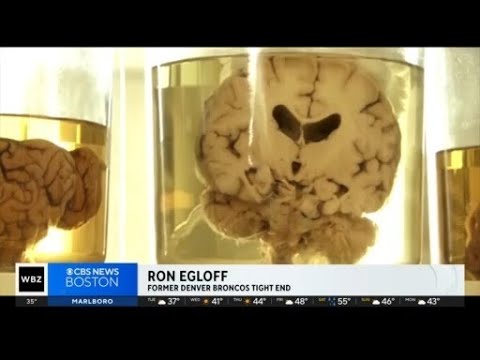 Boston University CTE study may lead to living diagnosis