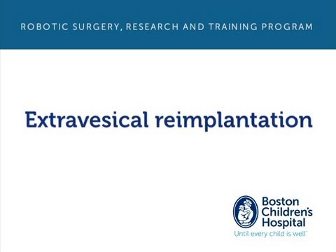 Extravesical reimplantation - Boston Children's Hospital