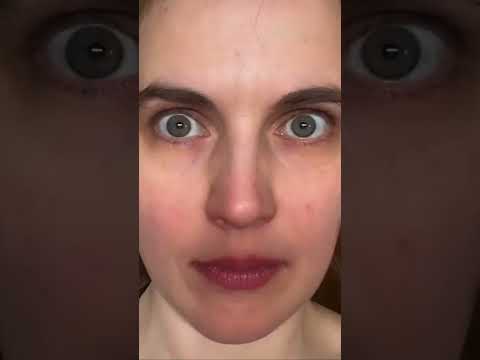 πππ Look at my EYES before and after pupil dilation!! #shorts