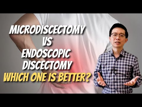 MICRODISCECTOMY ‼️ ENDOSCOPIC DISCECTOMY FOR SCIATICA & LUMBAR DISC HERNIATION | SECOND OPINION