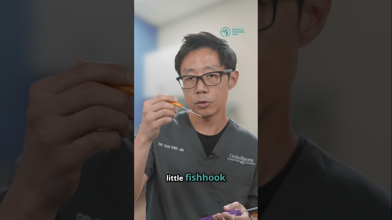 Dr Tan Ken Jin Explains Ankle Ligament Repair Surgery | #MCAShorts