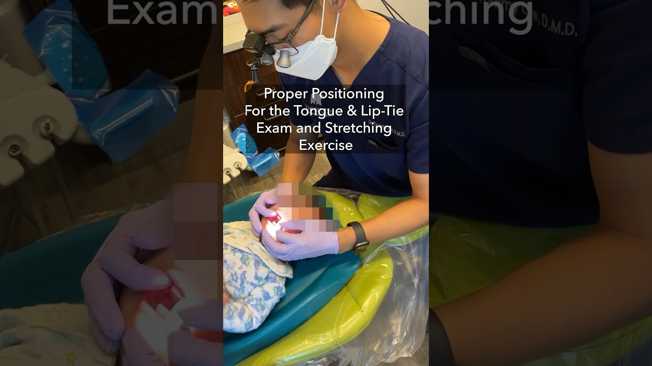 How to Check Tongue and Lip-Tie #tonguetie #liptie