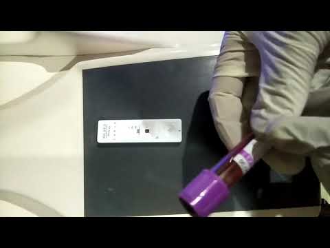 malaria test in laboratory, MP screening by ICT kit