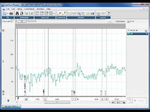 Automatically find a point and select Data in LabChart