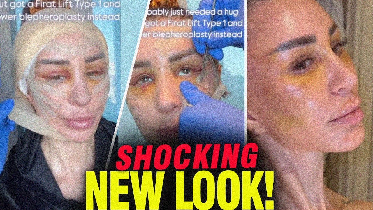 Shekinah Garner’s Shocking New Look! The 3rd Silva Sister After Extreme Surgery?