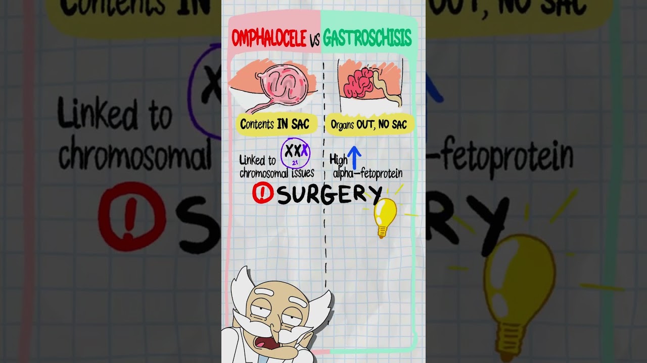 USMLE Step 1 & Step 2 CK: Pediatric GI Disorders Made Easy | High-Yield Mnemonics