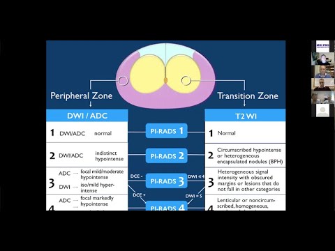 Prostate MRI MDM JUN 20