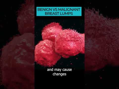 Benign vs Malignant Lumps: Know the Difference and Take Action 🩺🎗️💕