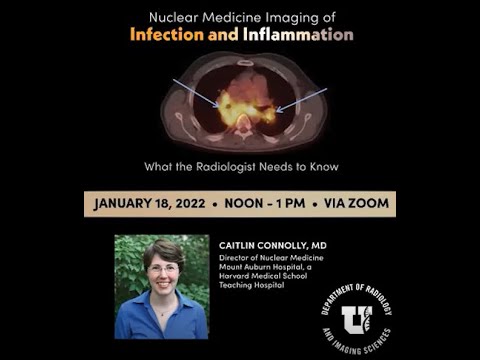 Nuclear Medicine Imaging of Infection and Inflammation: What the Radiologist Needs to Know
