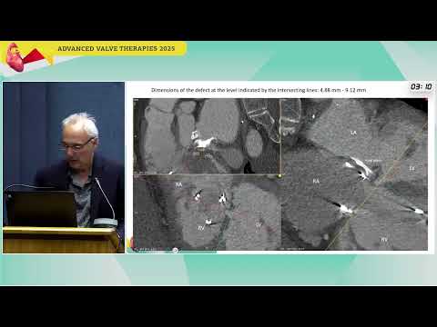 Ν. Mezilis | Case Presentation 4 St Luke’s Hospital