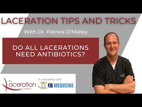Do all lacerations need antibiotics?