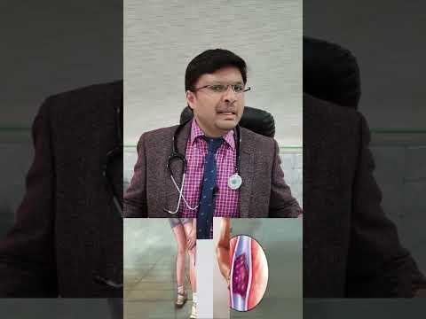 पैरों में सूजन/Pedal Edema: Unraveling the Causes of Swollen Feet"