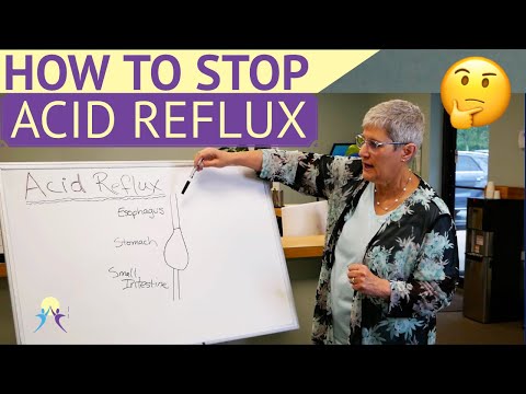 How To Stop ACID REFLUX [Symptoms & Treatment For HEARTBURN]