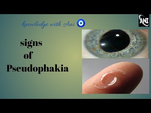 sign of pseudophakia | AK khurana ophthalmology | #knowledgewithani🧿