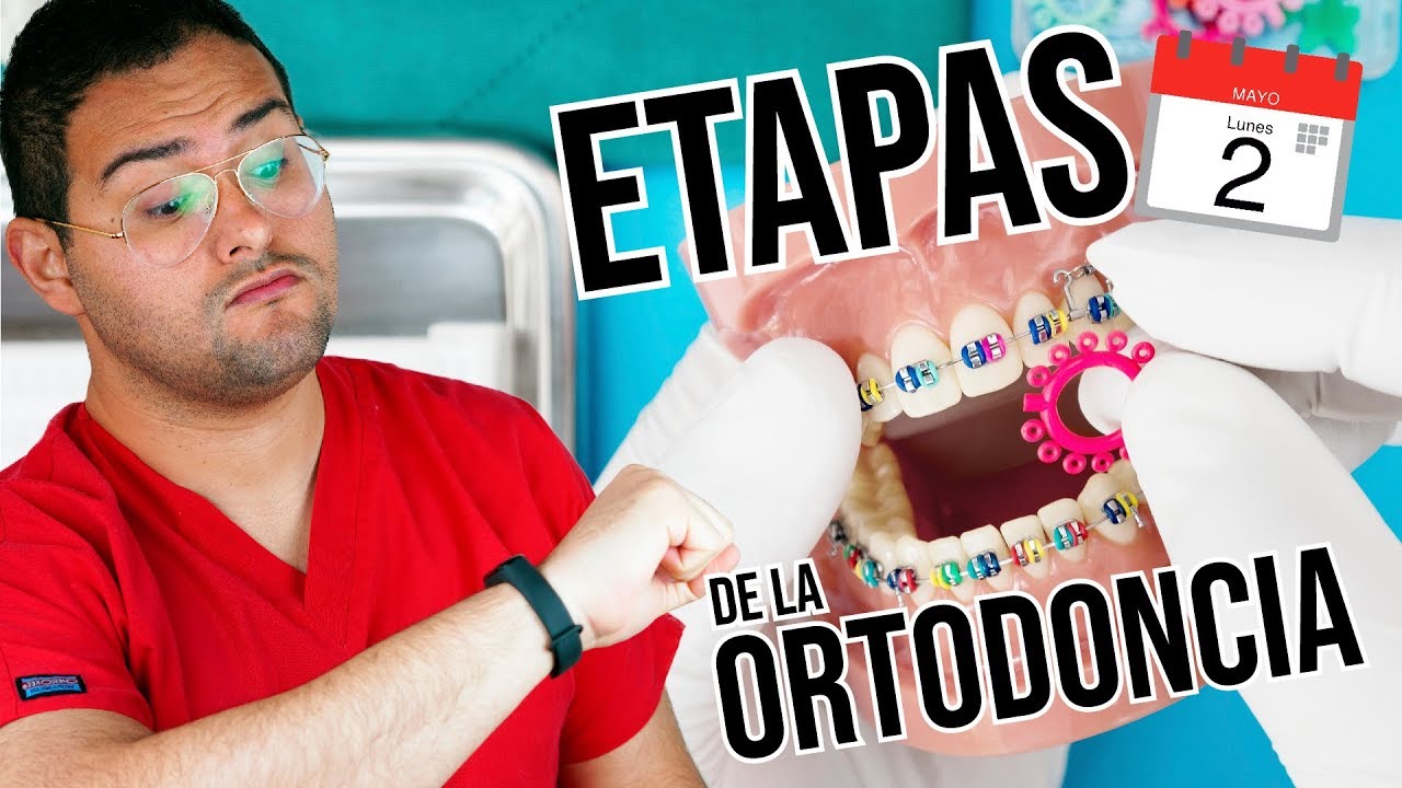 ETAPAS / FASES del tratamiento de BRACKETS ¿Cuanto TIEMPO DURA la ORTODONCIA?