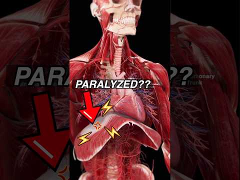 Doctor explains ALS in 60 seconds #ALS #Neuroscience