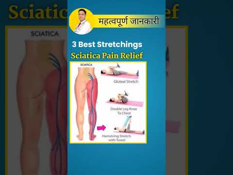 ✅Sciatica Pain Relief ✅ #shorts #physiodrdeepaksoni #sciatica