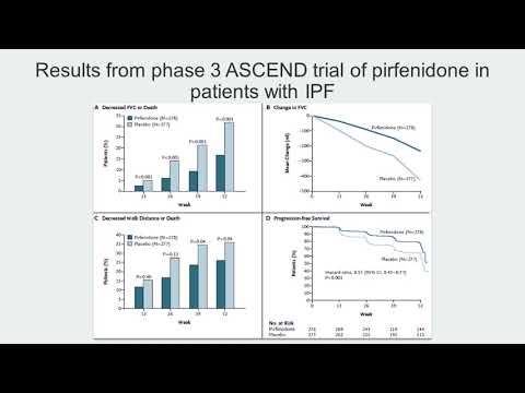 Trial Data (Track T Stop 4) IPF: Navigating a Complex Disease