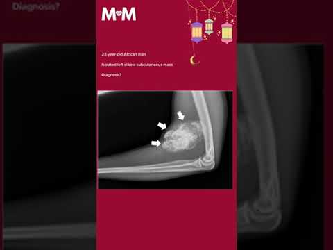 What is the diagnosis, #shorts part(2)