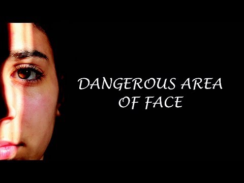 Dangerous area of face?