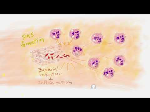 Neutrophil Function Concepts for MLS(ASCP), CLS, and MLT's