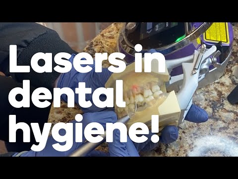 Four ways a dental hygienist can use lasers
