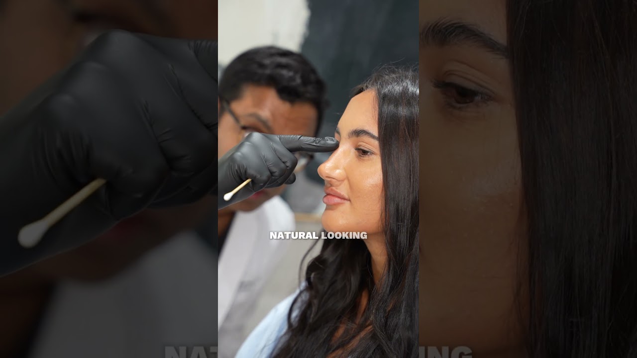 Are You a Good Candidate for Rhinoplasty - Toronto Facial Surgeon Explains