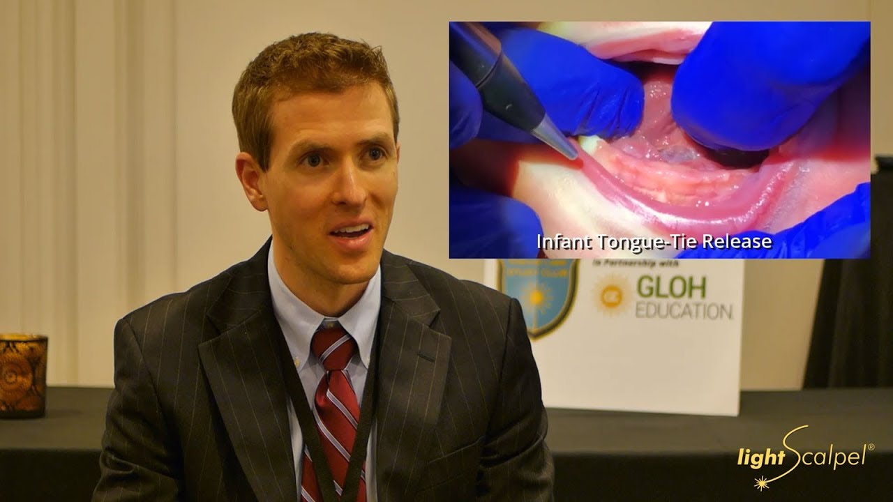 Richard Baxter, DMD, Discusses Tongue-Tie Releases