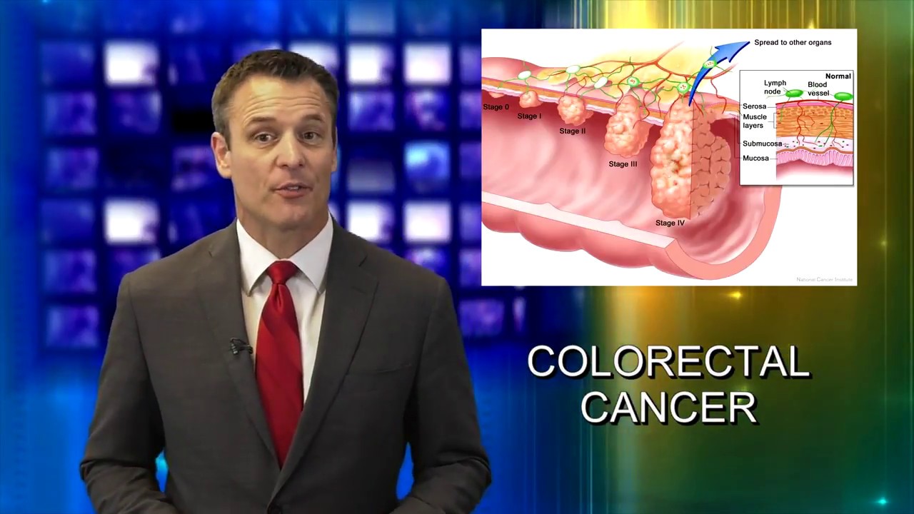 Gastroenterology of New Jersey Discusses Colon Cancer