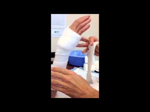 How To Apply A Short Arm Splint