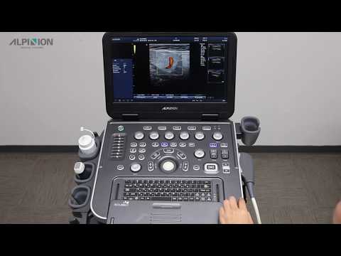Point of Care Ultrasound Machine - POCUS Latest Price, Manufacturers ...