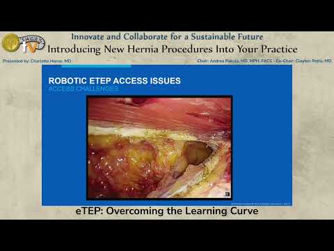 eTEP: Overcoming the Learning Curve