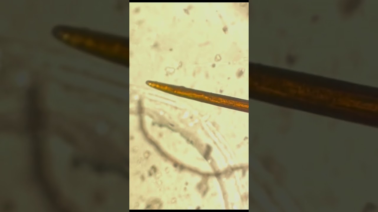 Bee sting under 100x magnification #beesting