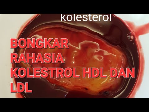 BONGKAR RAHASIA KOLESTEROL HDL dan LDL @sehat william episode 48