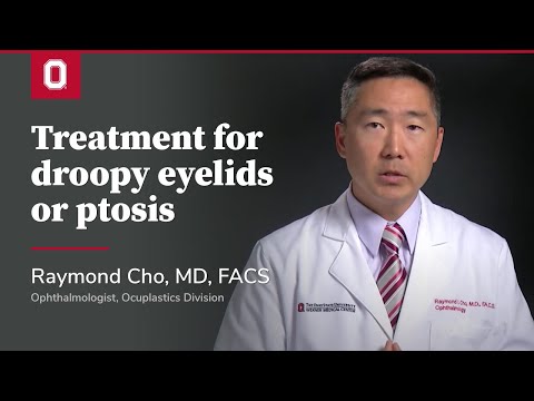 Treatment for droopy eyelids or ptosis | Ohio State Medical Center