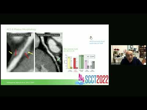 Sponsored Symposium | The future of CCT, what is needed, what could be done & what needs to be done