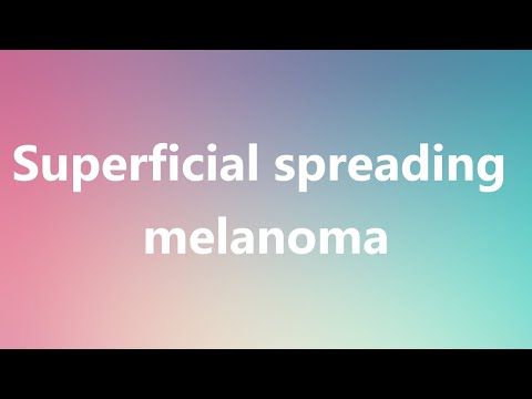 Superficial spreading melanoma - Medical Meaning and Pronunciation
