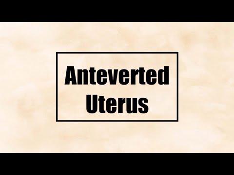 Anteverted Uterus Meaning: Symptoms, Diagnosis, Causes of Anteverted Uterus