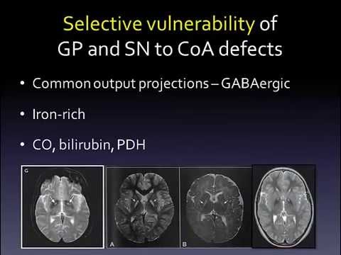 How defects in pantothenate metabolism cause neurodegeneration