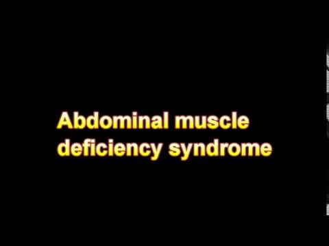 what is the definition of Abdominal muscle deficiency syndrome (Medical Dictionary Online)