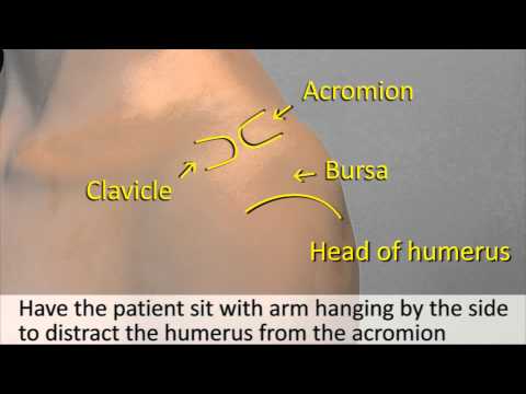 Musculoskeletal Examination and Joint Injection Series_ Subacromial Bursa Injection